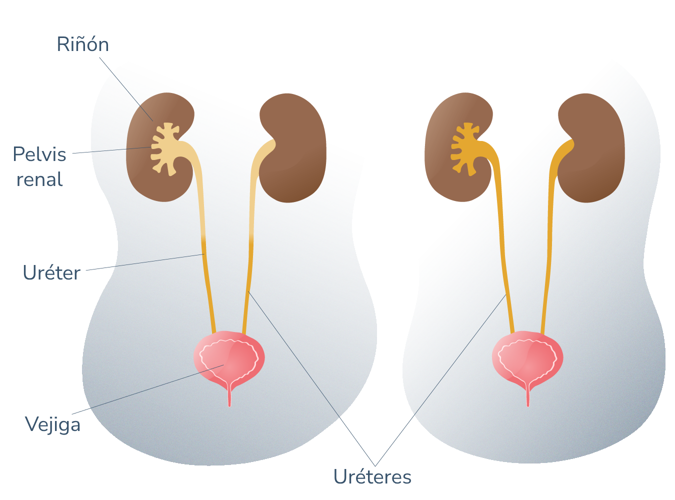 Reflujo vesicoureteral: una vida normal para tu hijo