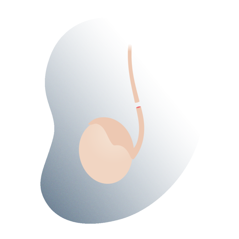 Vasectomy without queues or waiting. Payment up to 12 months