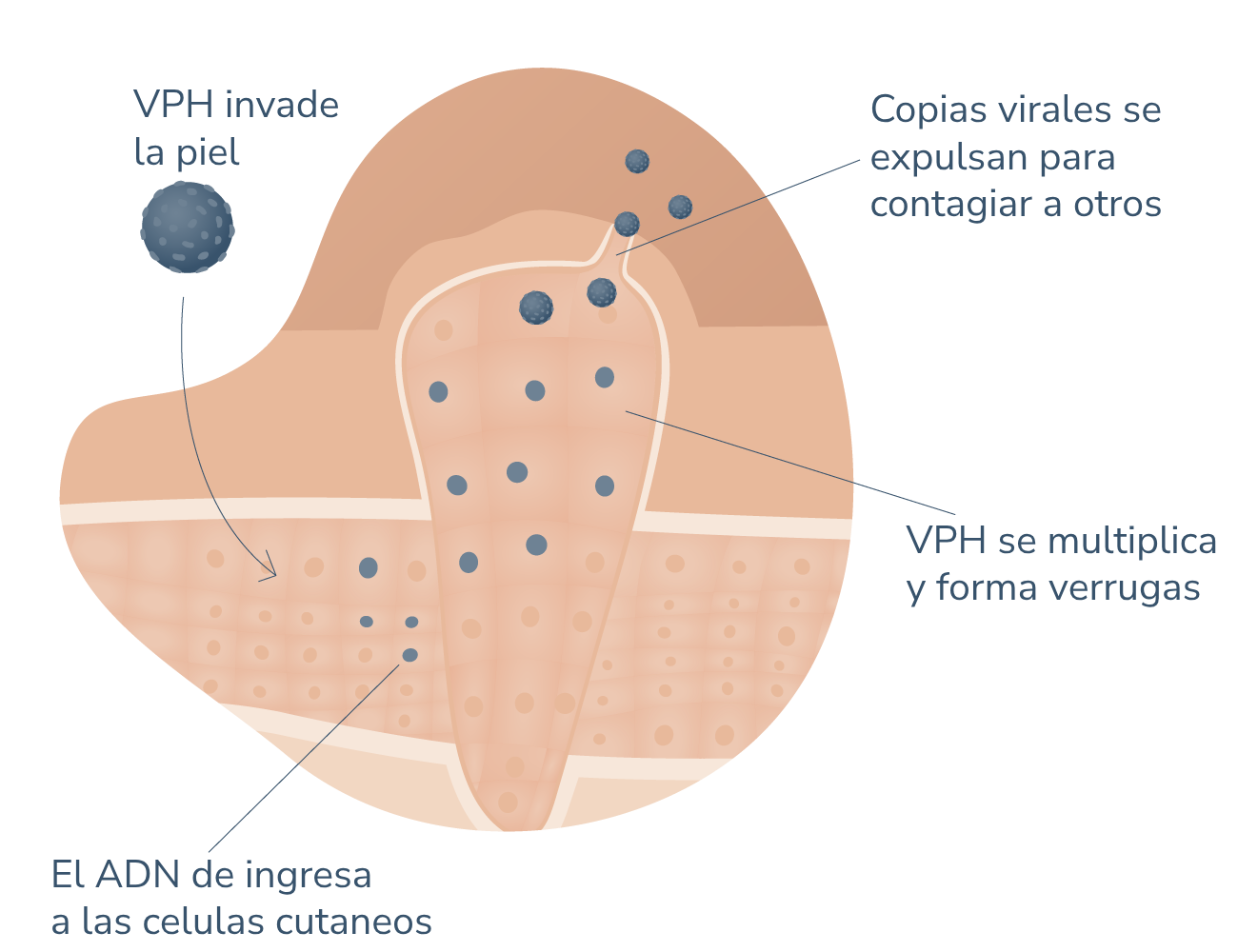 VPH / Virus del papiloma ¿Cómo se si lo tengo?